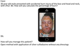 Fluid management in burns and shock | PPTX