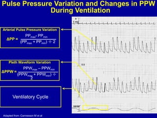 Fluid management and Fluid Responsiveness in ICCU / ICU at ASMIHA ...
