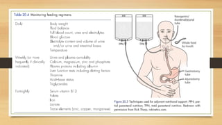 Fluid & Nutrition in Surgery Wards | PPTX