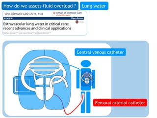 Assessment of fluid overload | PPTX