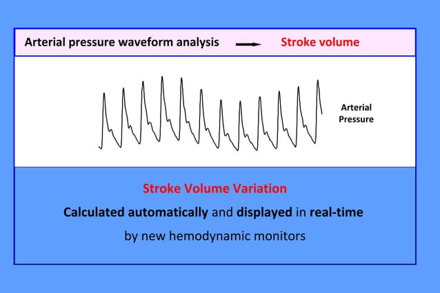 Fluid responsiveness in pratice | PPT | Heart and Cardiovascular ...