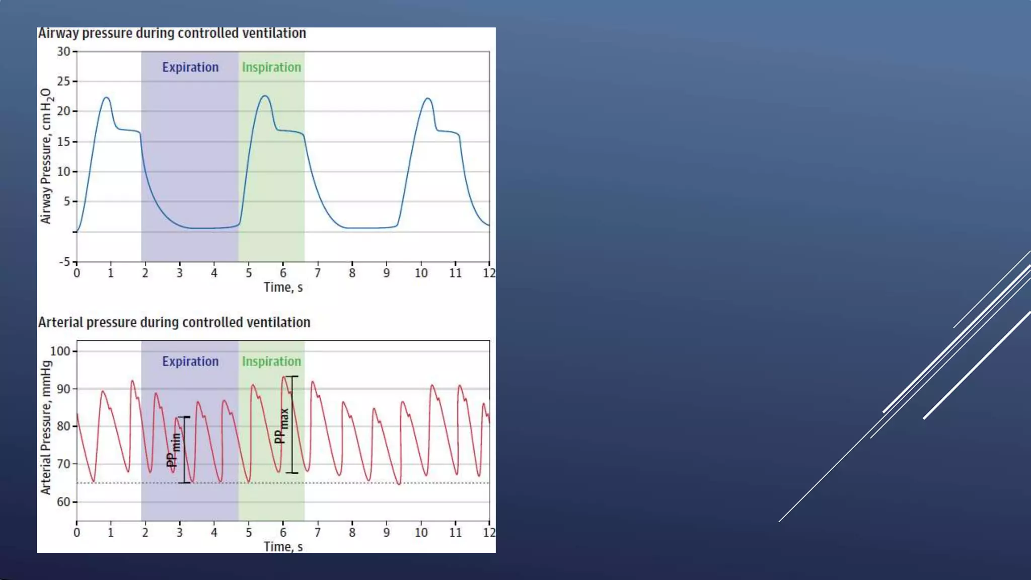fluid responsiveness.pptx