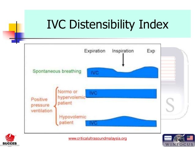 Đánh giá đáp ứng bù dịch