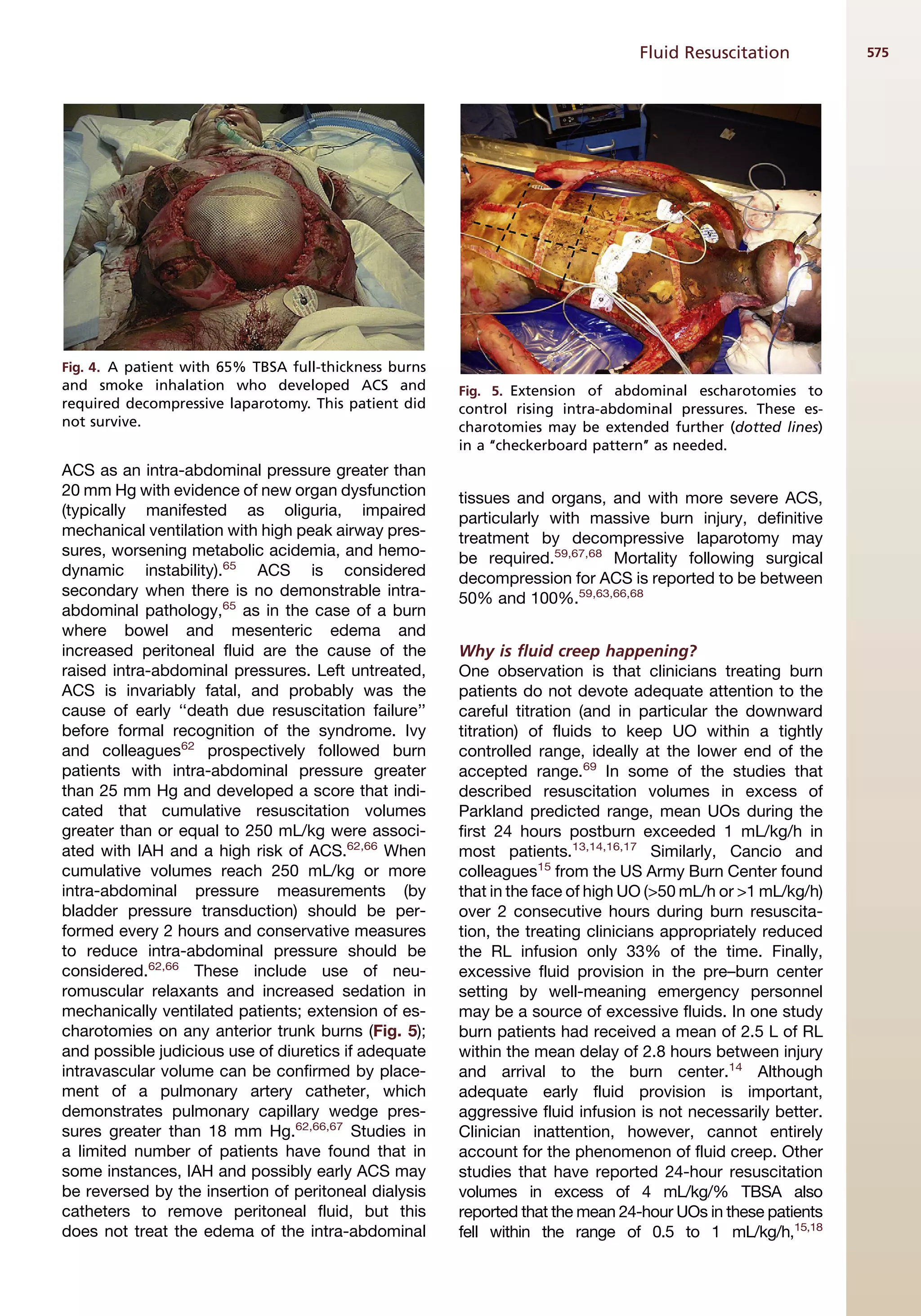 Fluid resuscitation burns 2009 | PDF