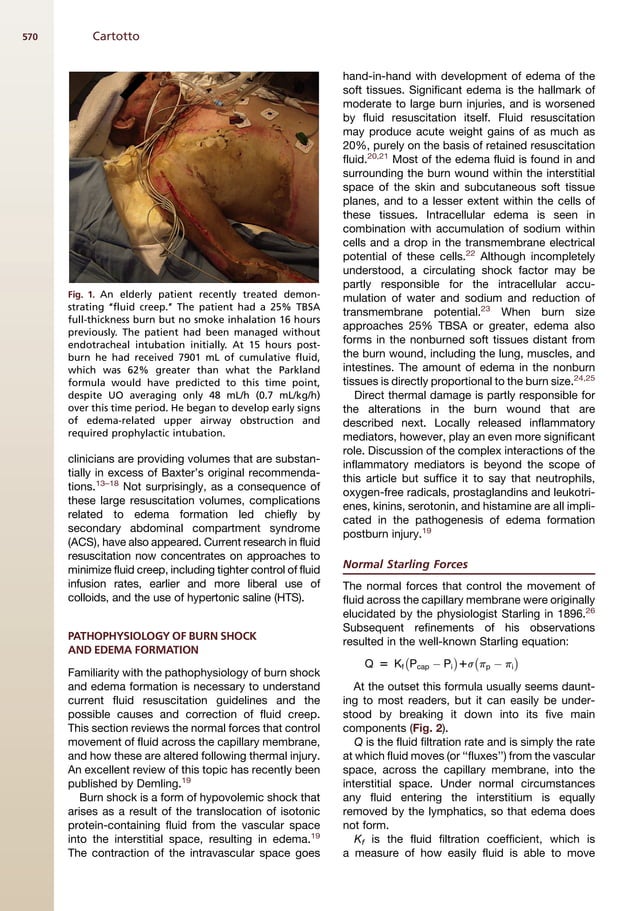 Fluid resuscitation burns 2009 | PDF