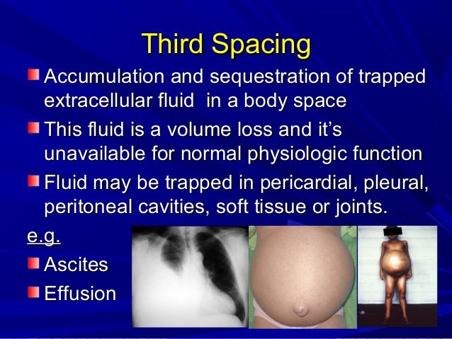 Fluids and electrolytes2015