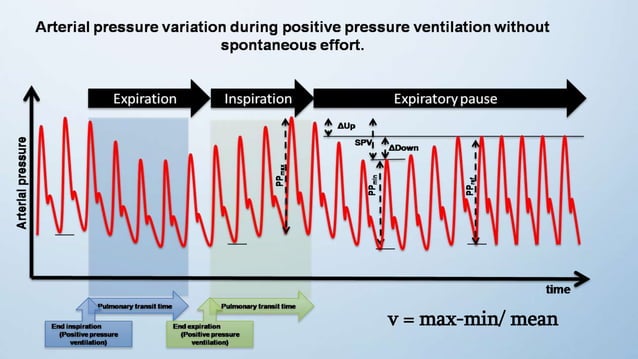 Fluid Therapy In AKI | PPTX | First Aid | Injuries