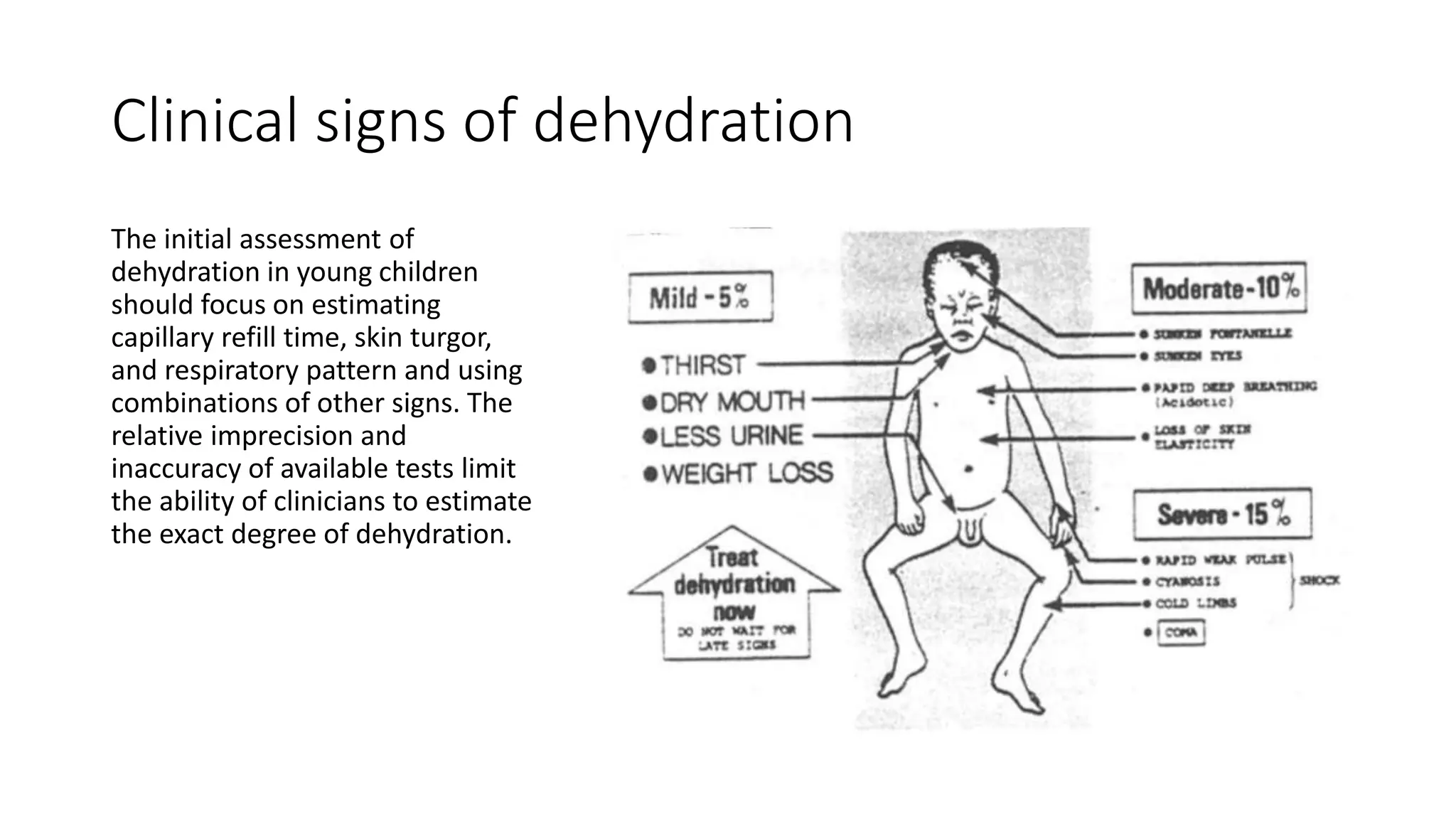 Fluid therapy in children | PPTX