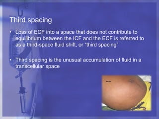Fluid volume imbalances | PPTX