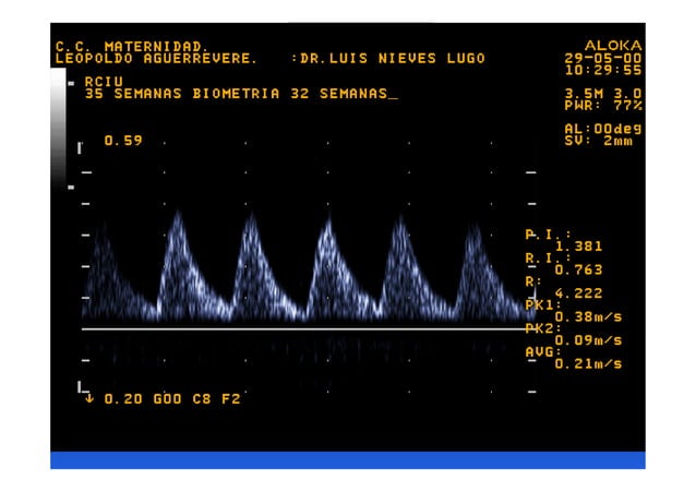 Flujometria doppler | PDF | Pregnancy | Reproductive Health