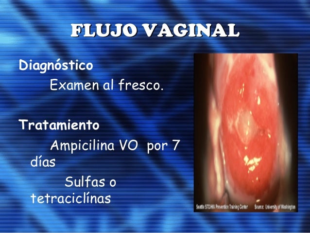 Flujo vaginal