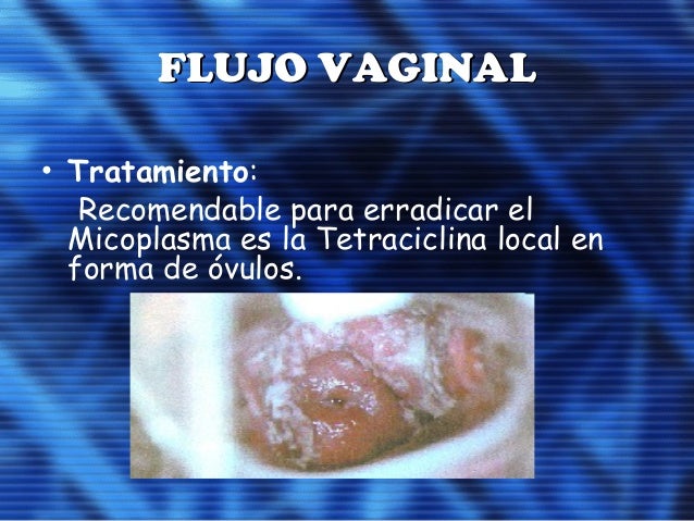 ¿Cuándo Es Normal El Flujo Vaginal Abundante Durante La Ovulación – BZLU