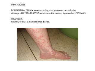 Flumetasona | PPTX