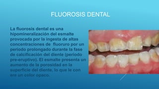 Fluor | PPTX