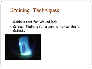 Fluorescein in Ophthalmology | PPTX