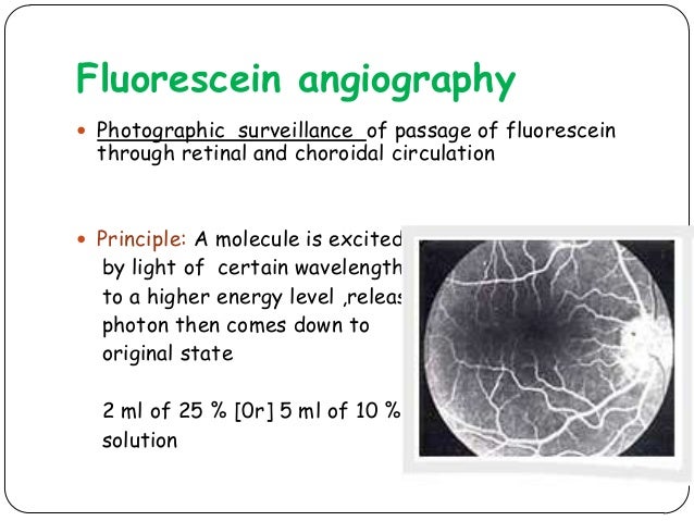 Fluorescein in Ophthalmology