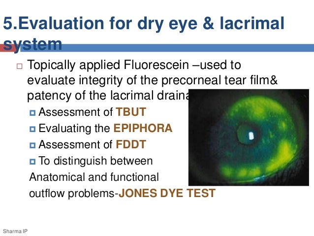 Fluorescein Stain