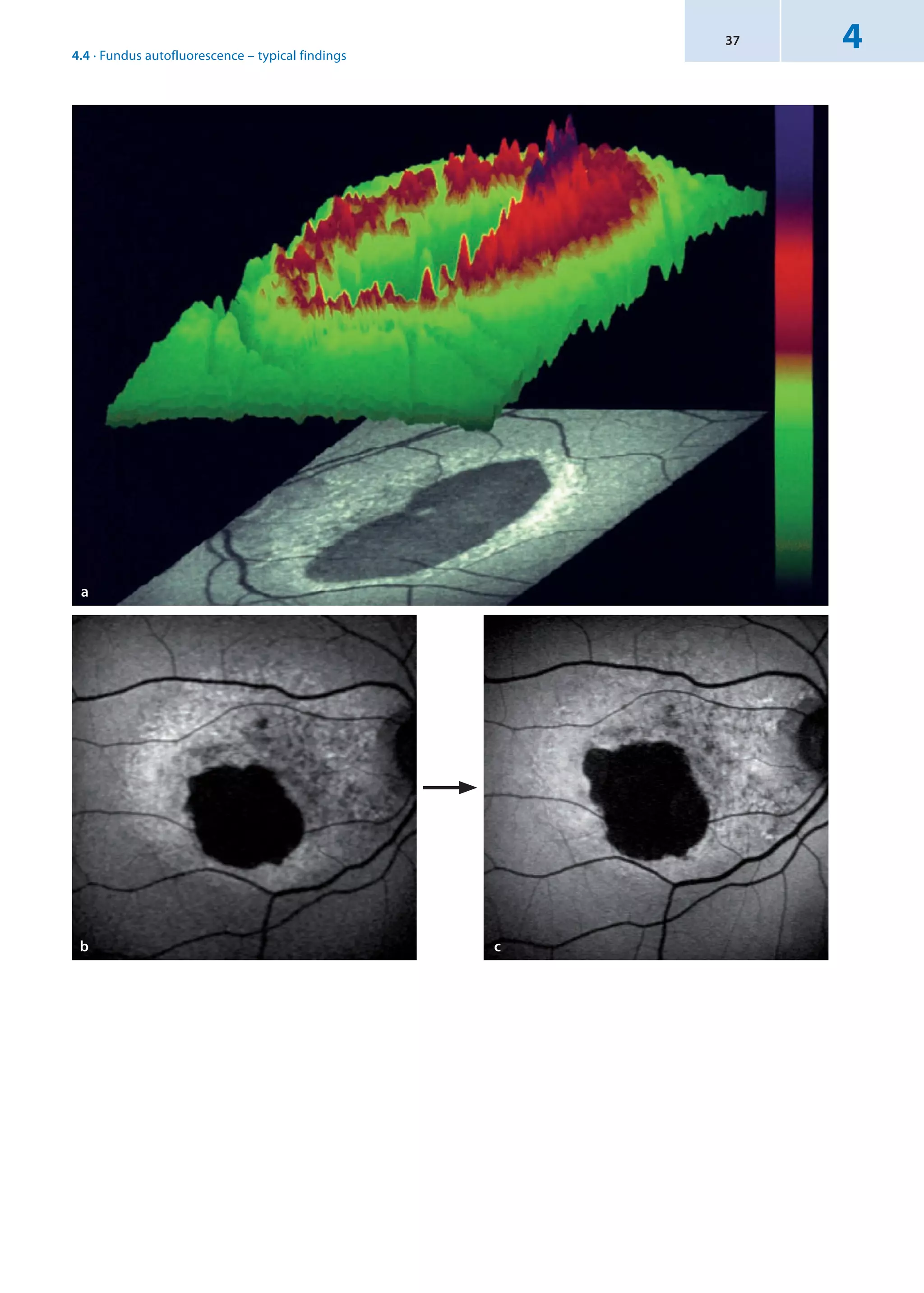 Fluorescence Angiography in Ophthalmology.pdf