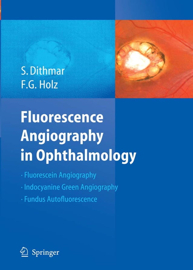 Fluorescence Angiography in Ophthalmology.pdf