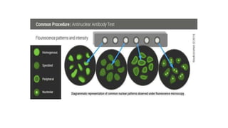 Fluorescence antibody test | PPTX