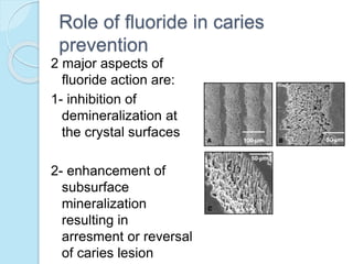 Fluoridated elastic chain | PPT | Dental Health | Diseases and Conditions