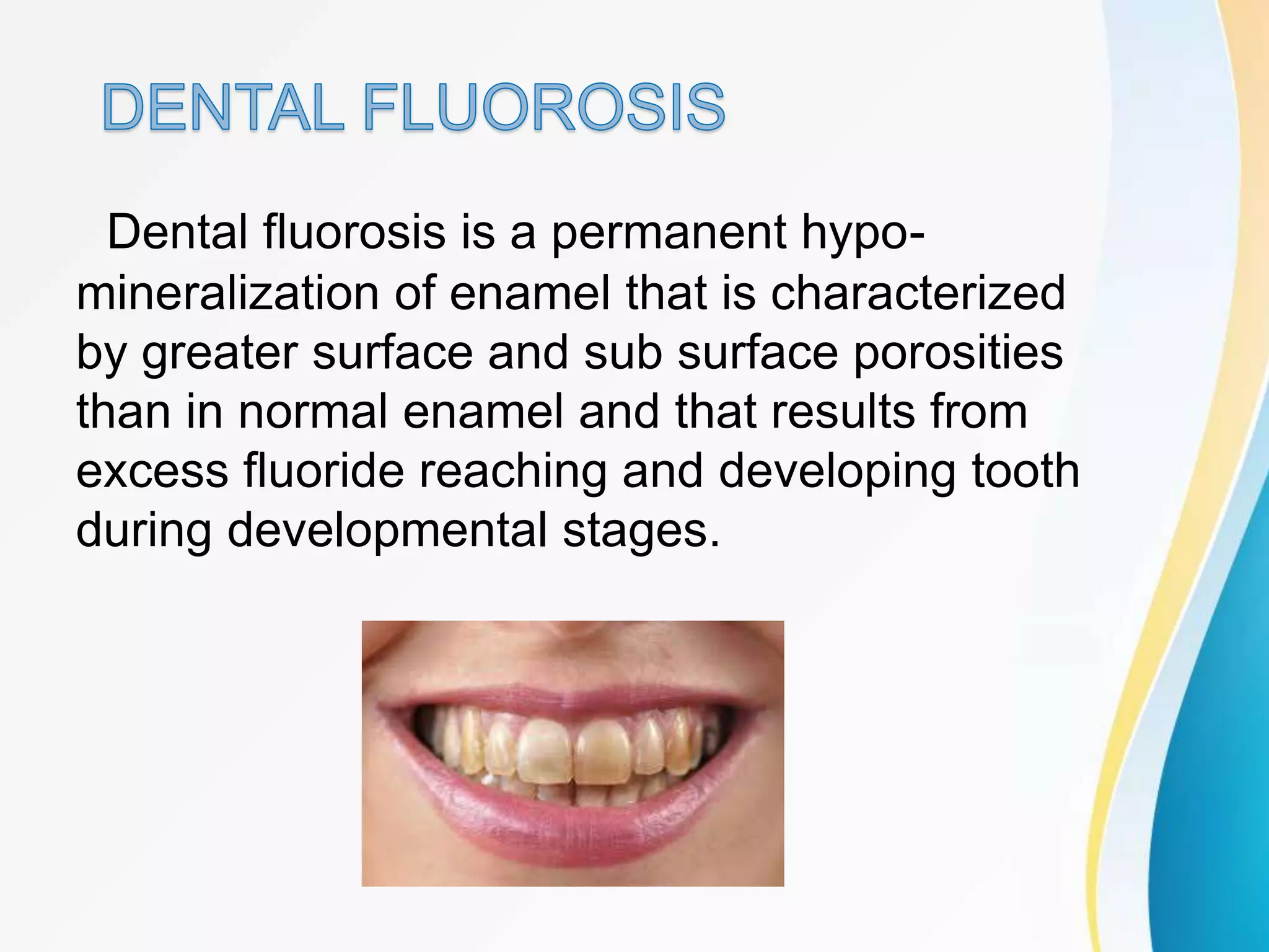 Fluoride: Human health and Caries prevention | PPTX