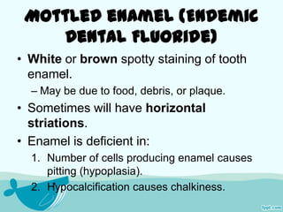Fluoride and their role in dental caries prevention | PPTX