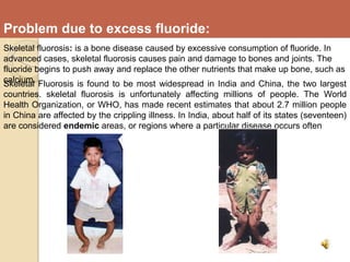 Fluoride problem in drinking water | PPTX
