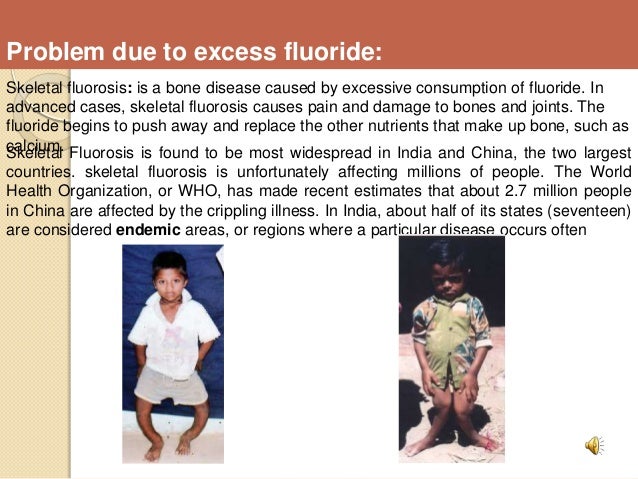 Fluoride problem in drinking water