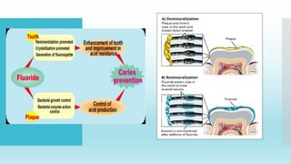 fluorides in dentistry.pptx
