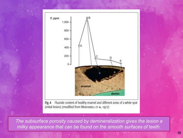 Fluorides ppt neha | PPTX | Dental Health | Diseases and Conditions