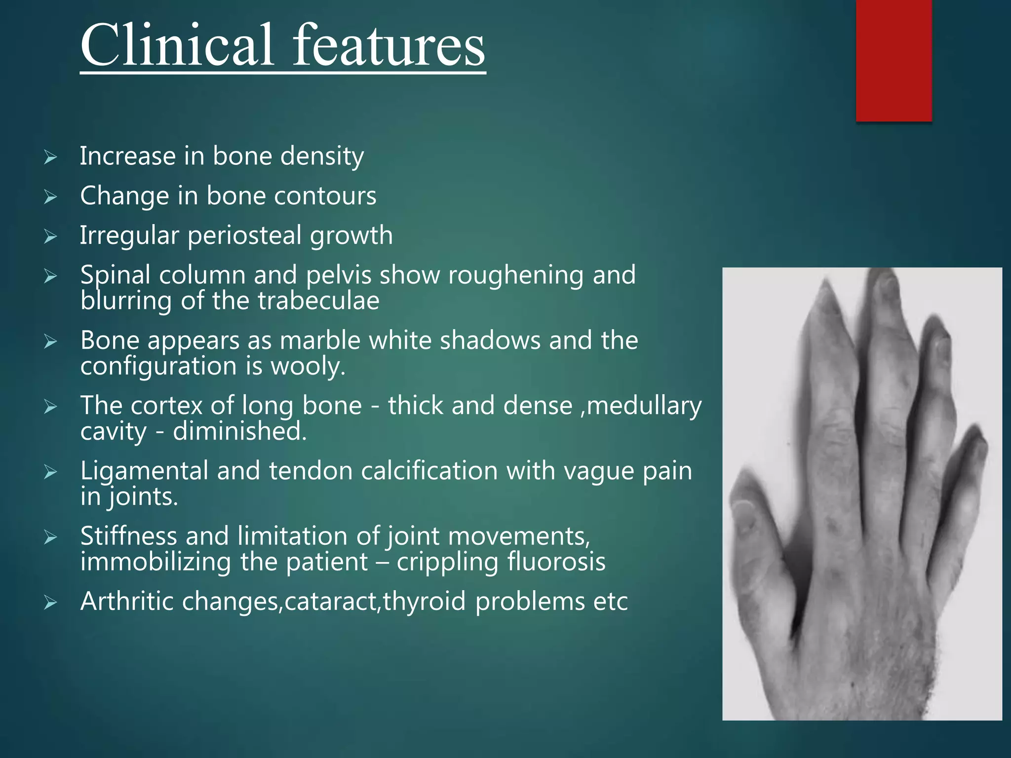 Fluoride toxicity - slideshare | PPTX