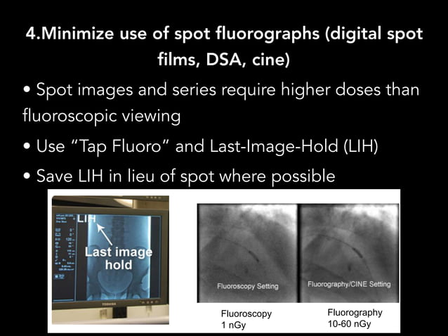 Fluoroscopy for Residents in Radiology | PDF