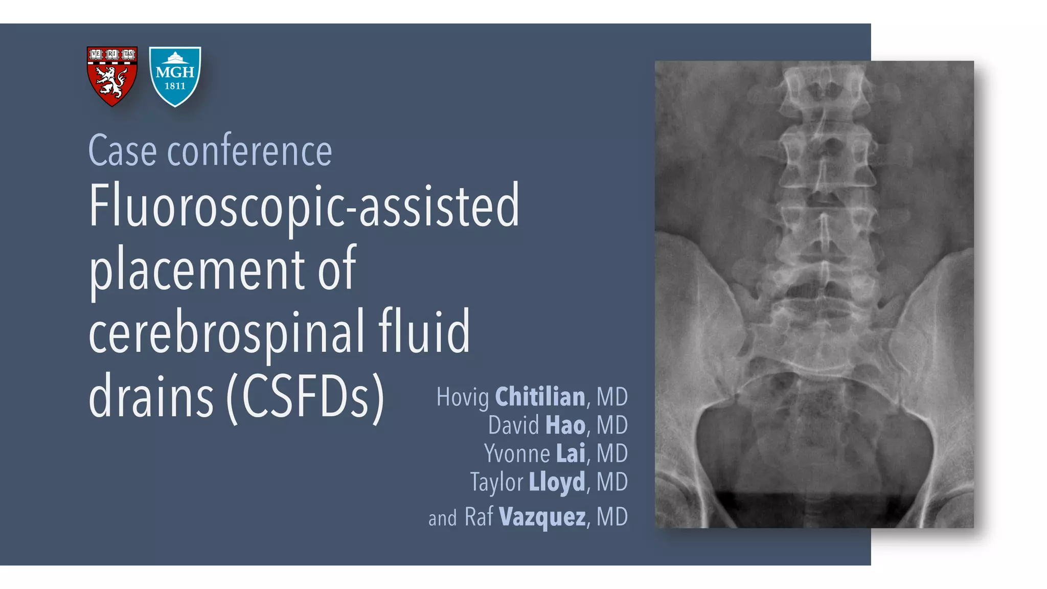 Fluoroscopic-assisted placement of cerebrospinal fluid drains (CSFDs) | PPT