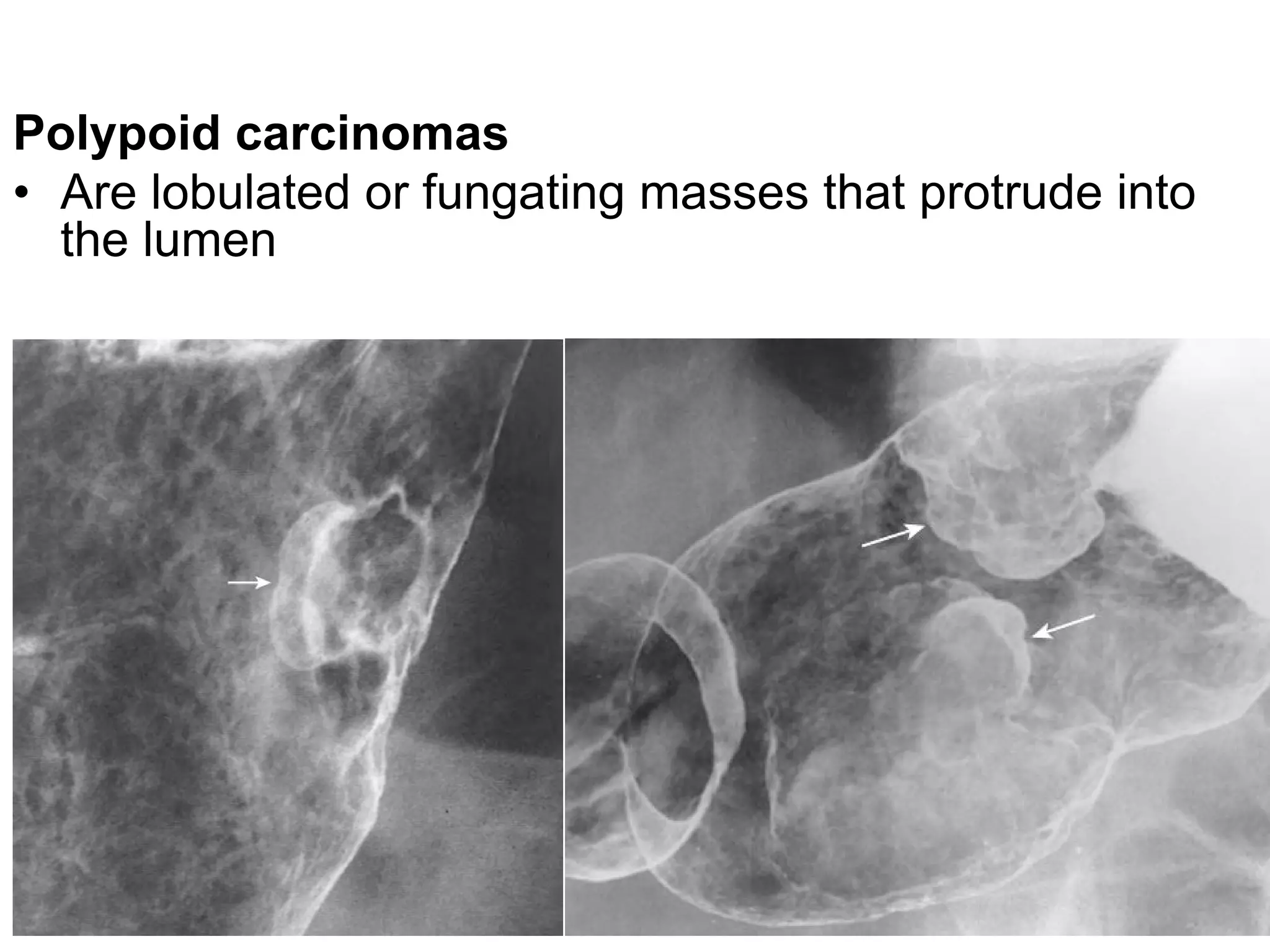 Fluoroscopic imaging anatomy and pathology of stomach and duodenum ...