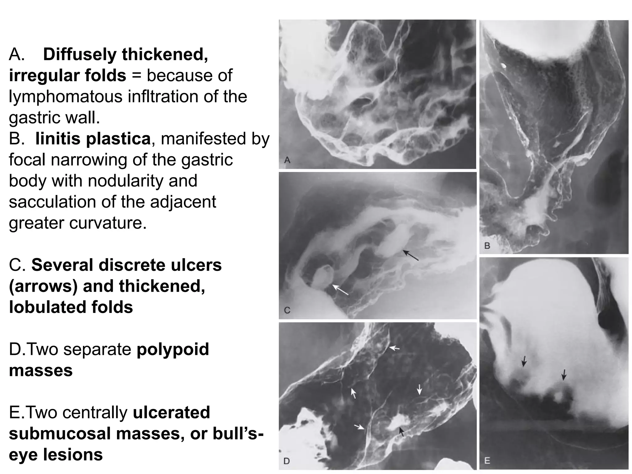 Fluoroscopic imaging anatomy and pathology of stomach and duodenum ...