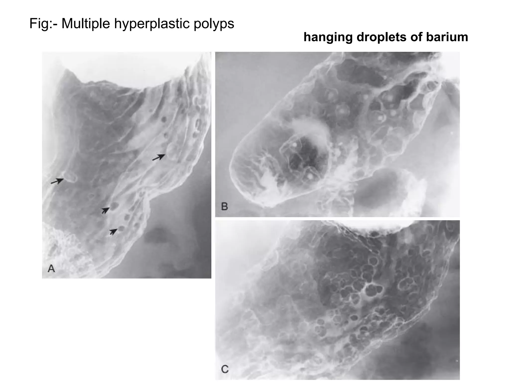 Fluoroscopic imaging anatomy and pathology of stomach and duodenum ...