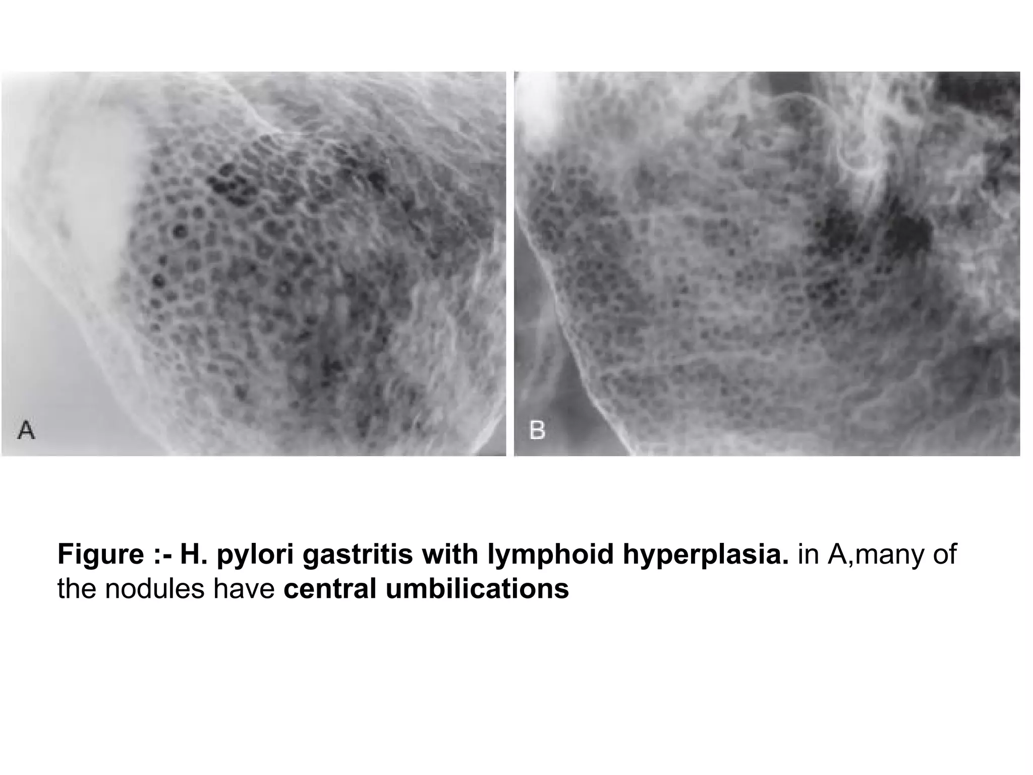 Fluoroscopic imaging anatomy and pathology of stomach and duodenum ...