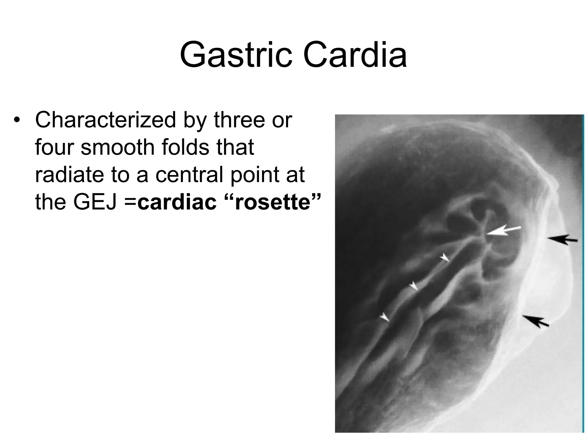 Fluoroscopic imaging anatomy and pathology of stomach and duodenum ...