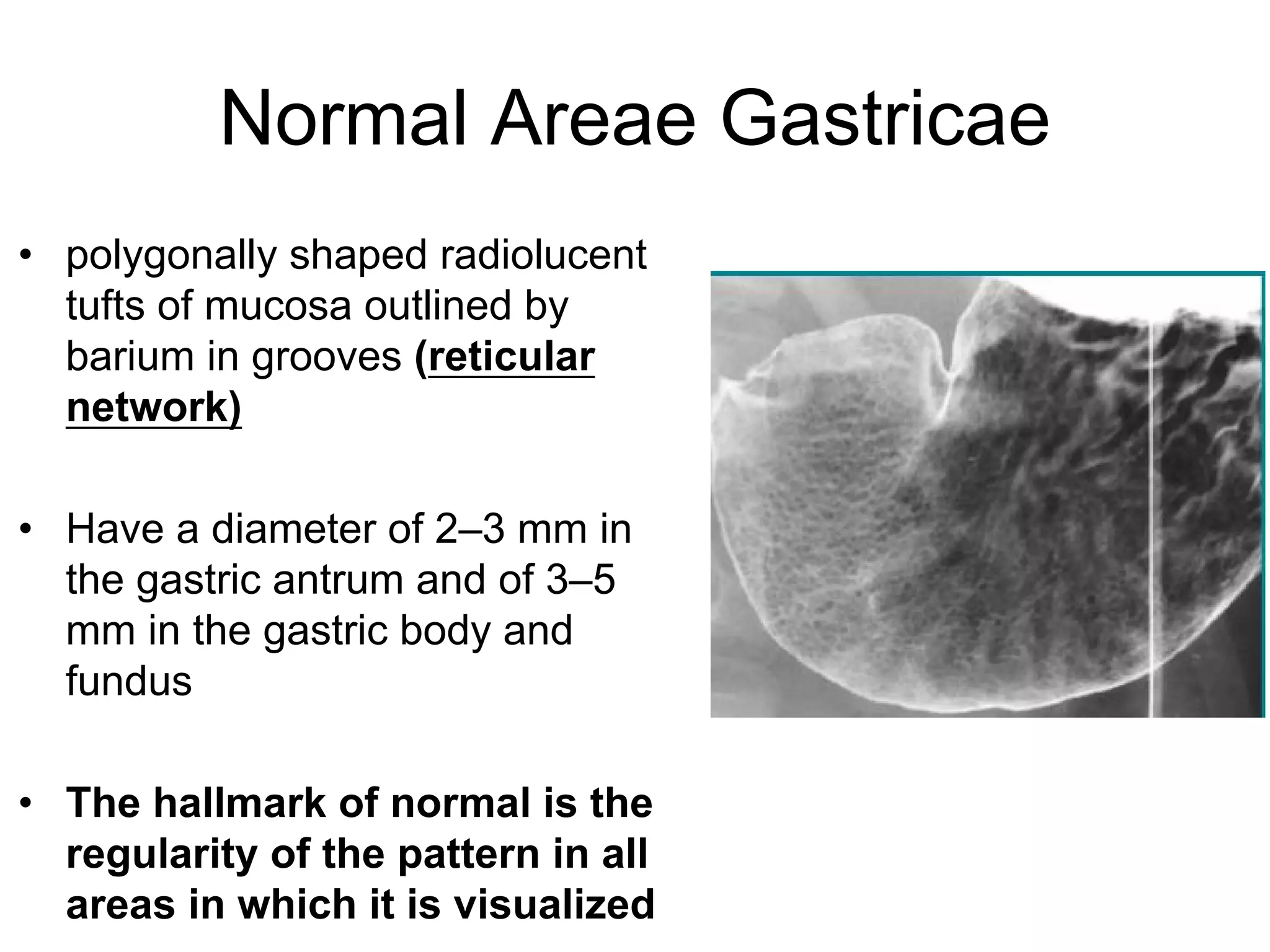 Fluoroscopic imaging anatomy and pathology of stomach and duodenum ...