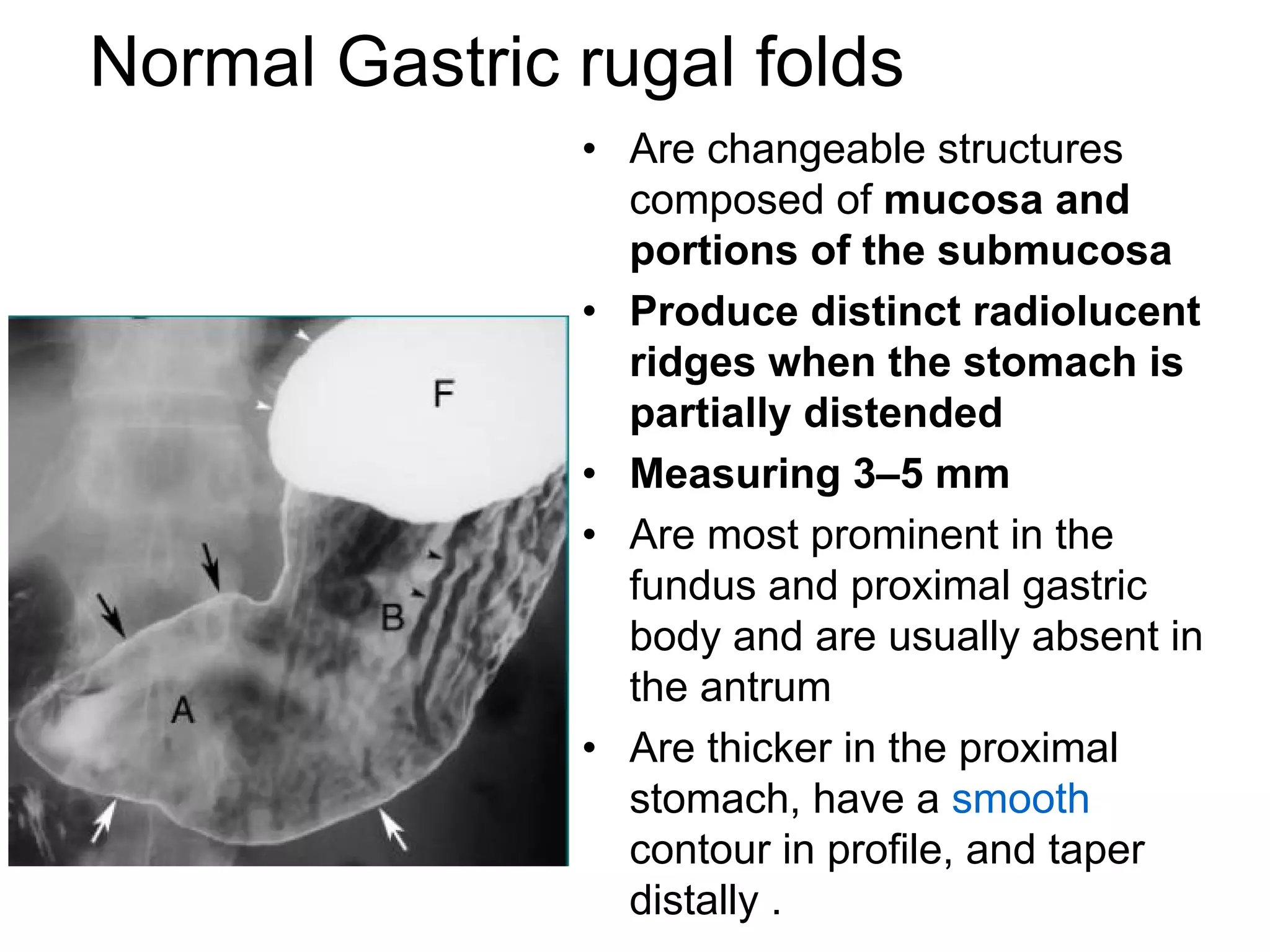 Fluoroscopic imaging anatomy and pathology of stomach and duodenum ...