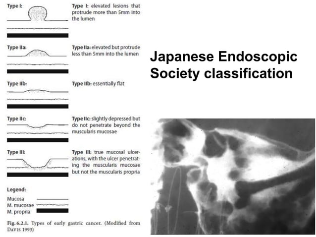 Fluoroscopic imaging anatomy and pathology of stomach and duodenum ...