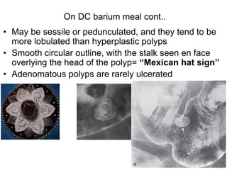 Fluoroscopic imaging anatomy and pathology of stomach and duodenum ...