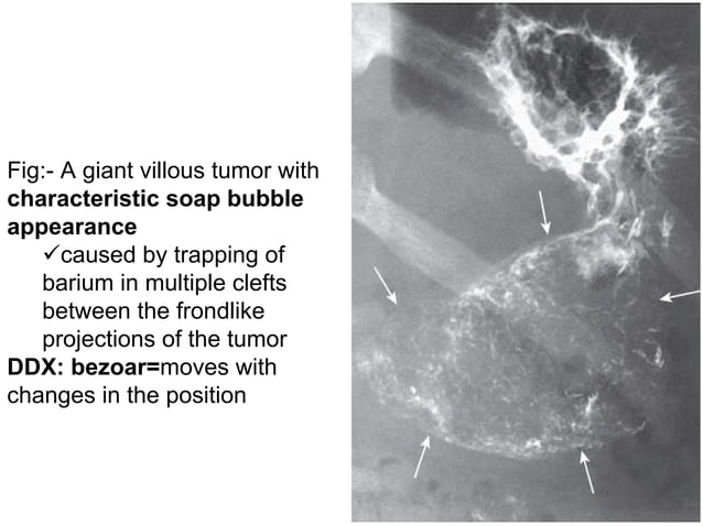 Fluoroscopic imaging anatomy and pathology of stomach and duodenum ...