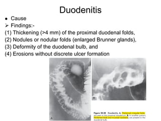 Fluoroscopic imaging anatomy and pathology of stomach and duodenum ...
