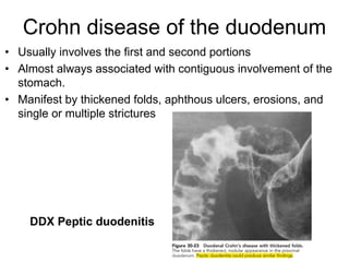 Fluoroscopic imaging anatomy and pathology of stomach and duodenum ...