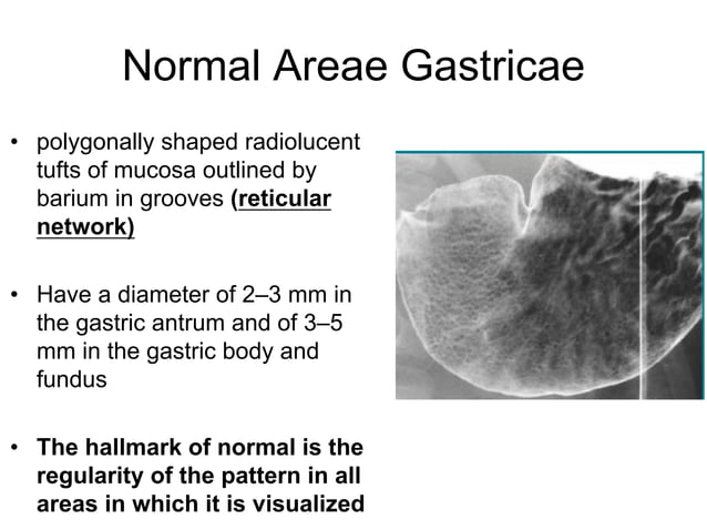 Fluoroscopic imaging anatomy and pathology of stomach and duodenum ...