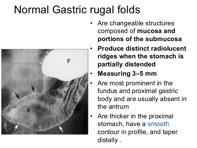Fluoroscopic imaging anatomy and pathology of stomach and duodenum ab…