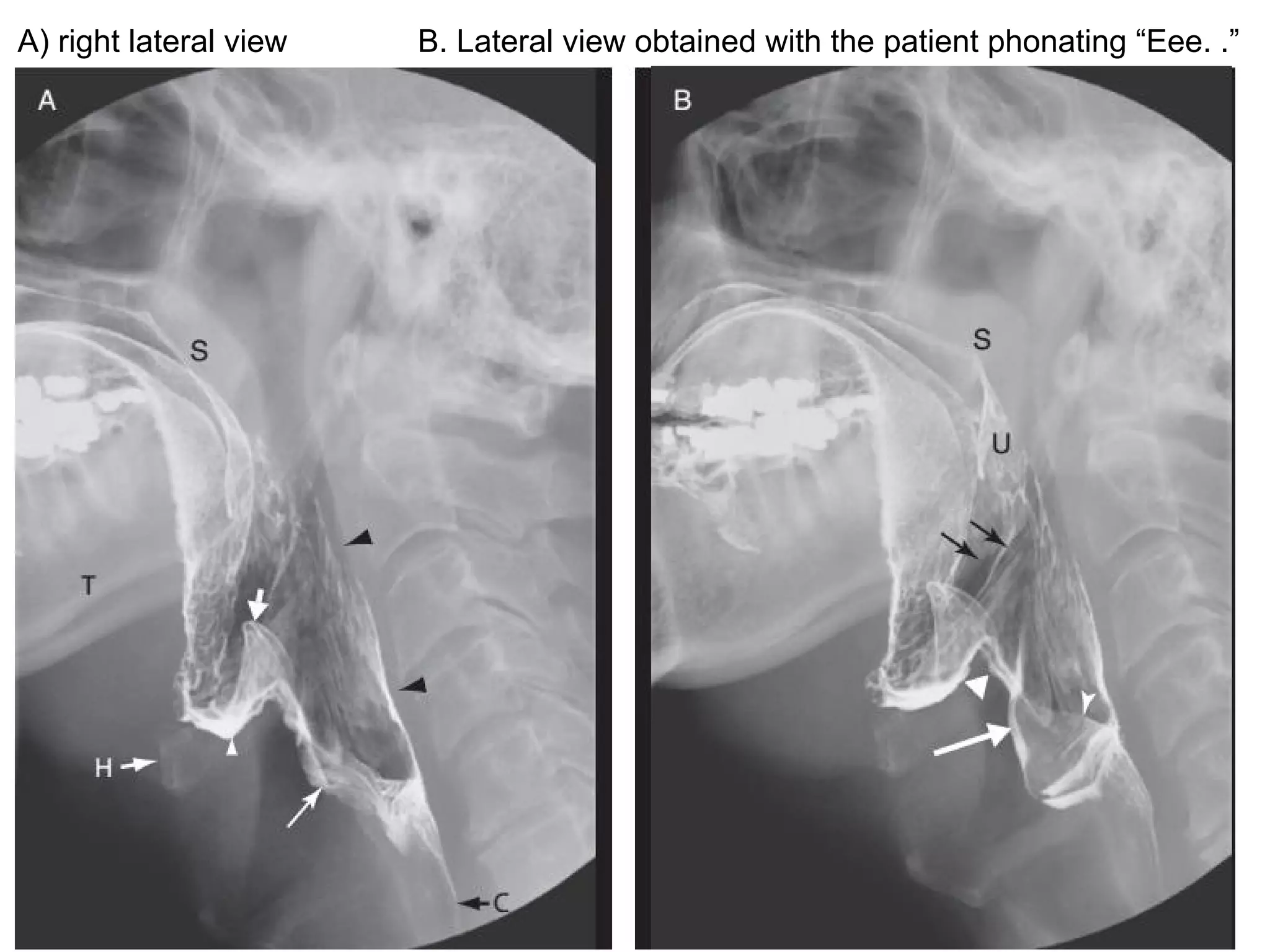 Fluoroscopic techniques and anatomy of pharynx and esophagus final | PDF