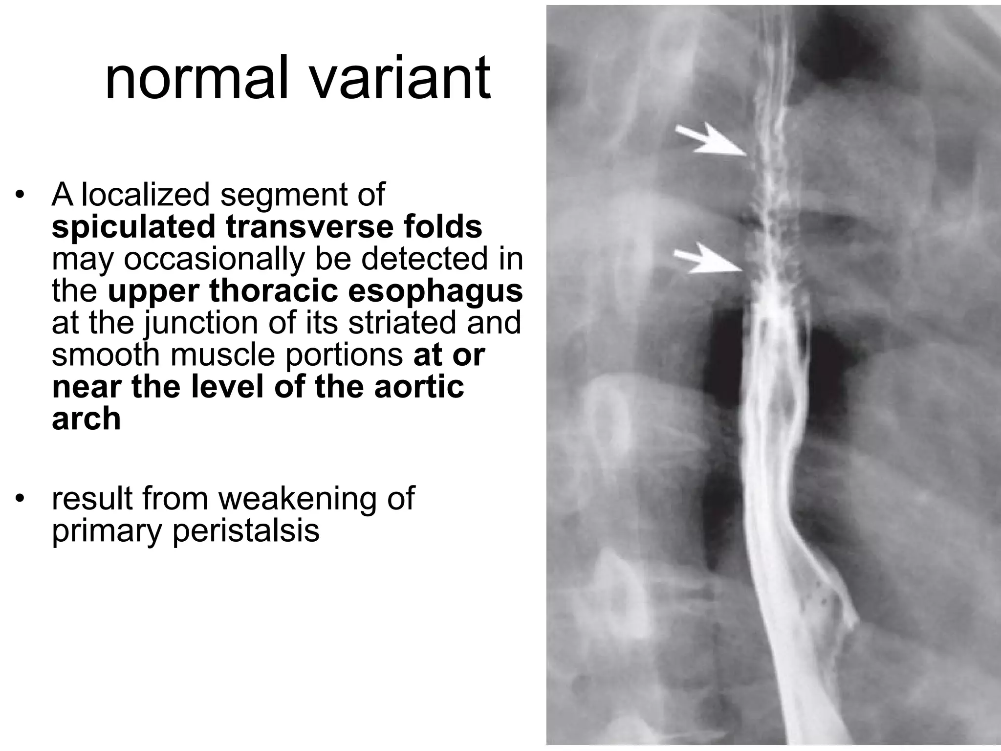 Fluoroscopic techniques and anatomy of pharynx and esophagus final | PDF